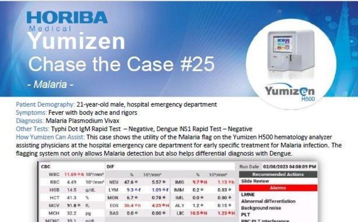 HORIBA News - HORIBA