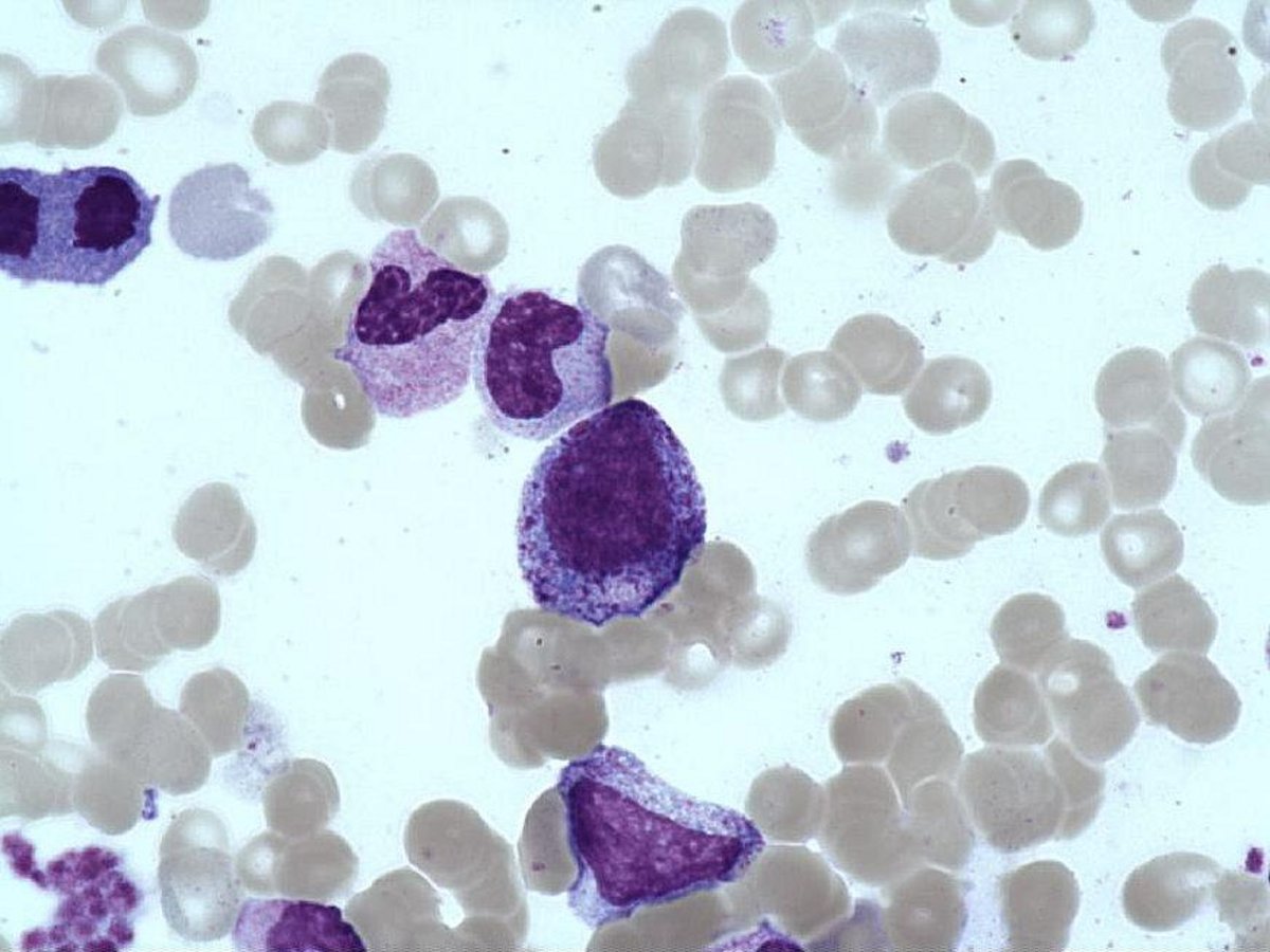Promyelocyte - HORIBA