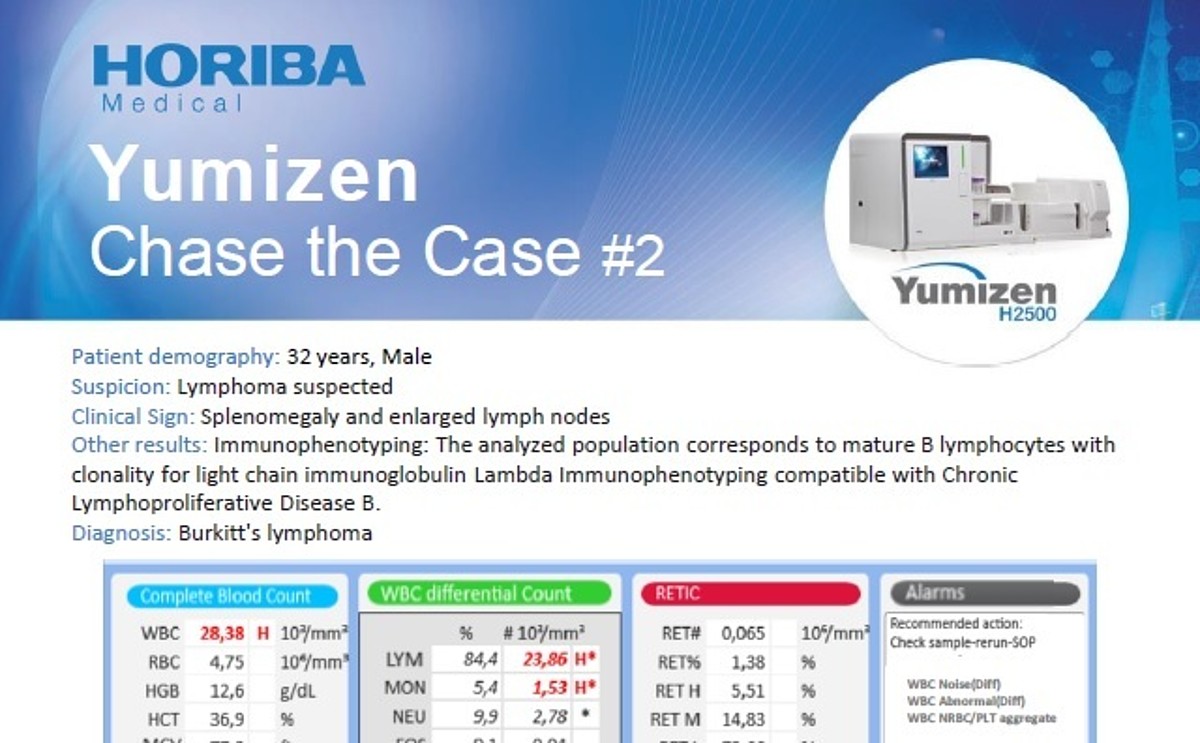 HORIBA News - HORIBA