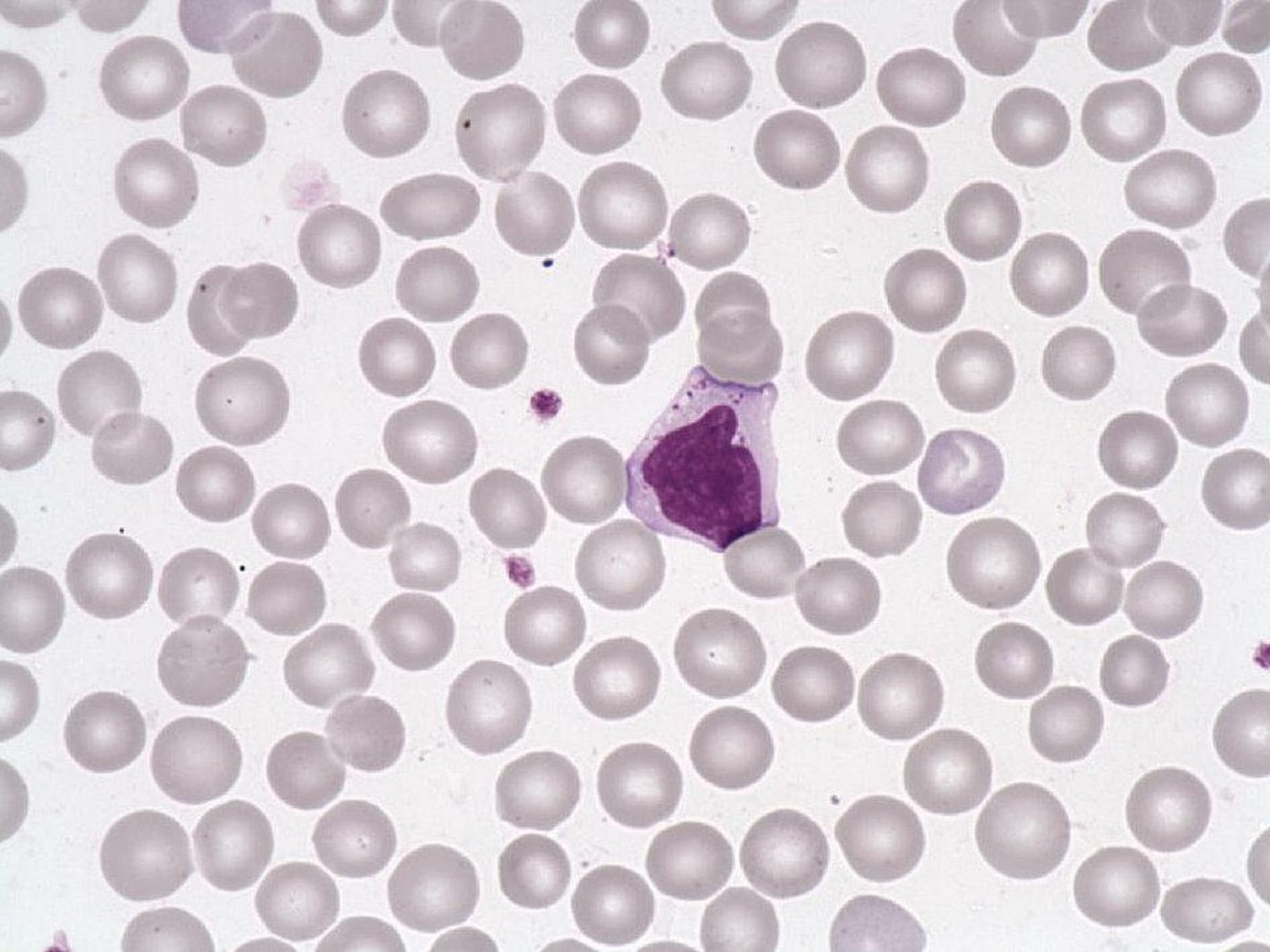 Large granular lymphocyte - HORIBA