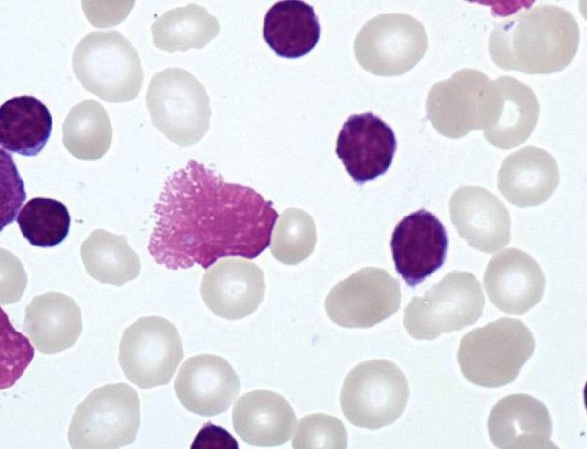 Smudge cell - HORIBA