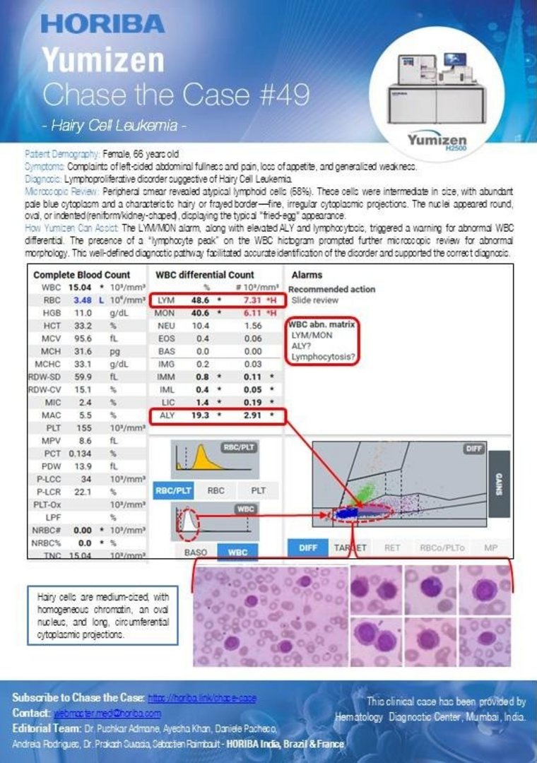 Chronic Lymphocytic Leukemia - Hematology Clinical Case "Chase the Case" #49 - HORIBA
