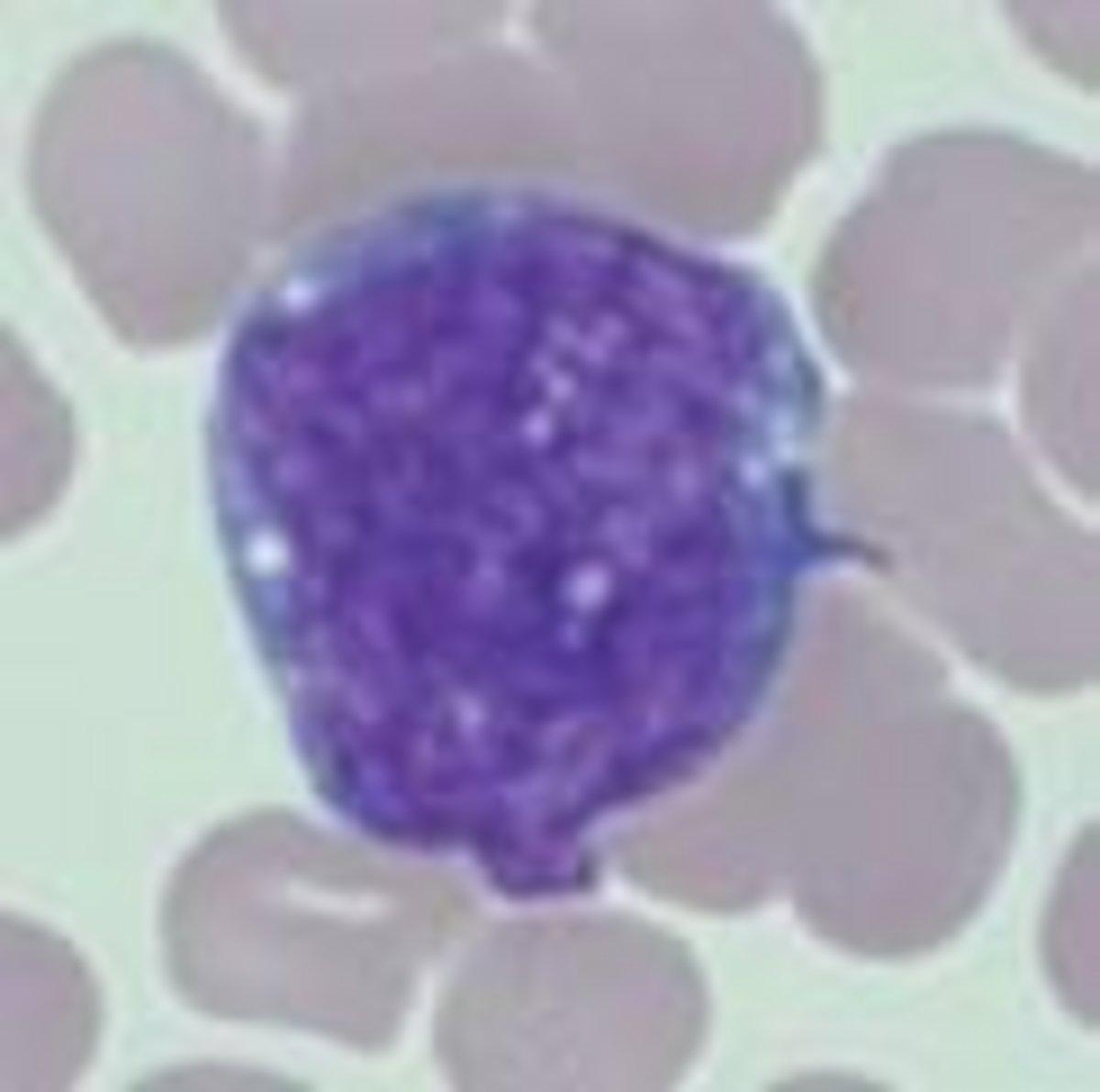 Nucleated Red Blood Cell (NRBC) - Blood Cell Morphology Newsletter #44