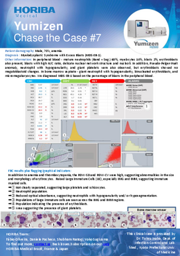 Myelodysplastic Syndrome with Excess Blasts (MDS-EB-1)