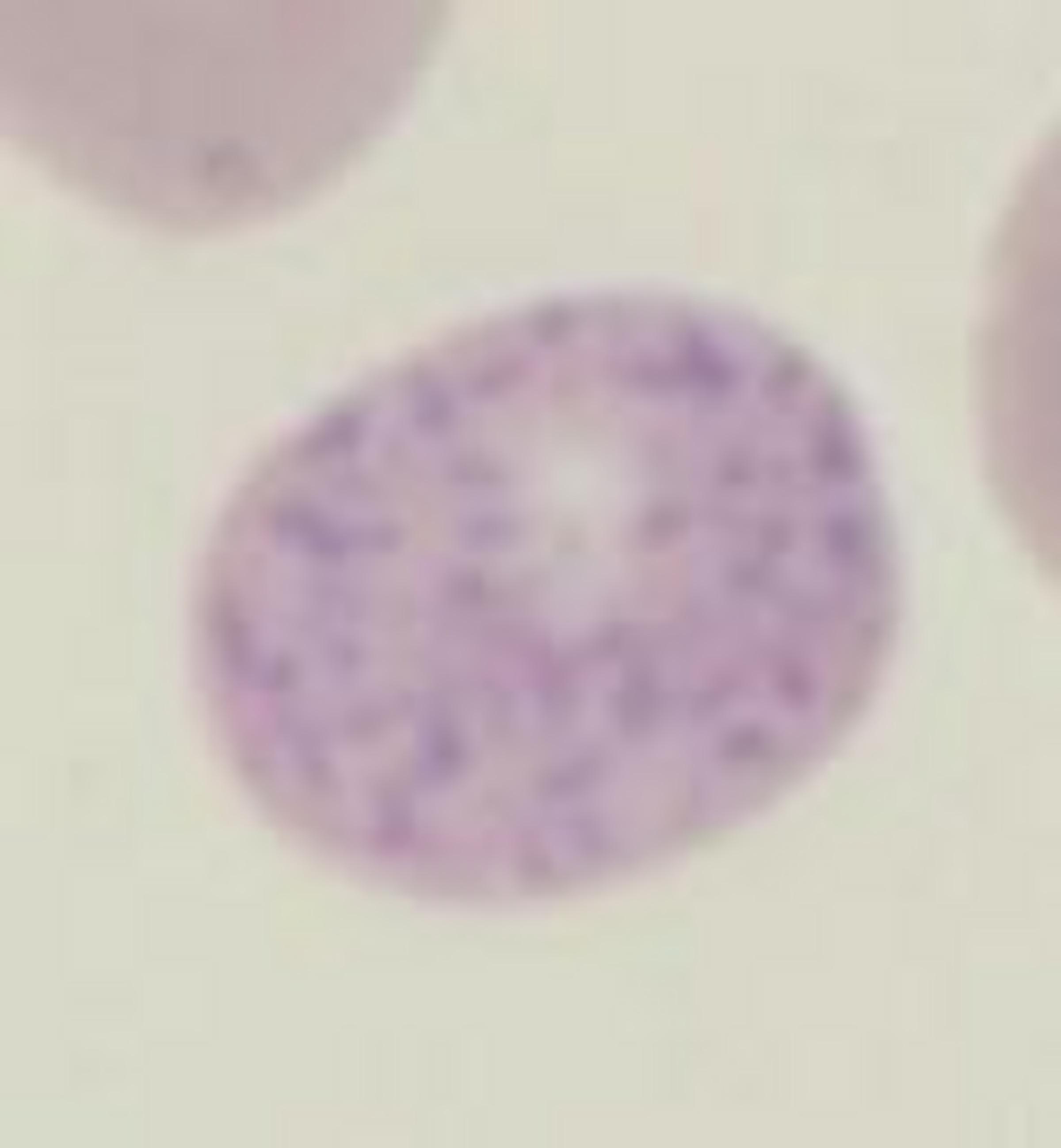 Matutes Score - Blood Cell Morphology Newsletter #41 (HORIBA Medical)