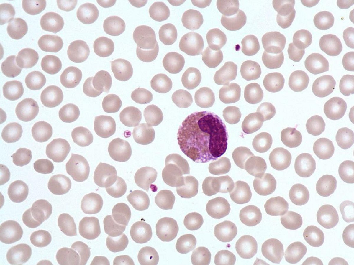 Eosinophil metamyelocyte - HORIBA