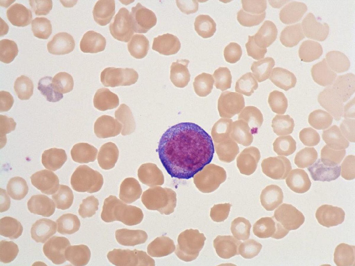 Myeloblast - HORIBA