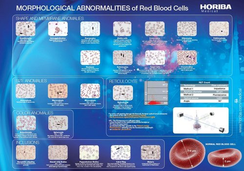 Learning Blood Cell Morphology - HORIBA for Healthcare