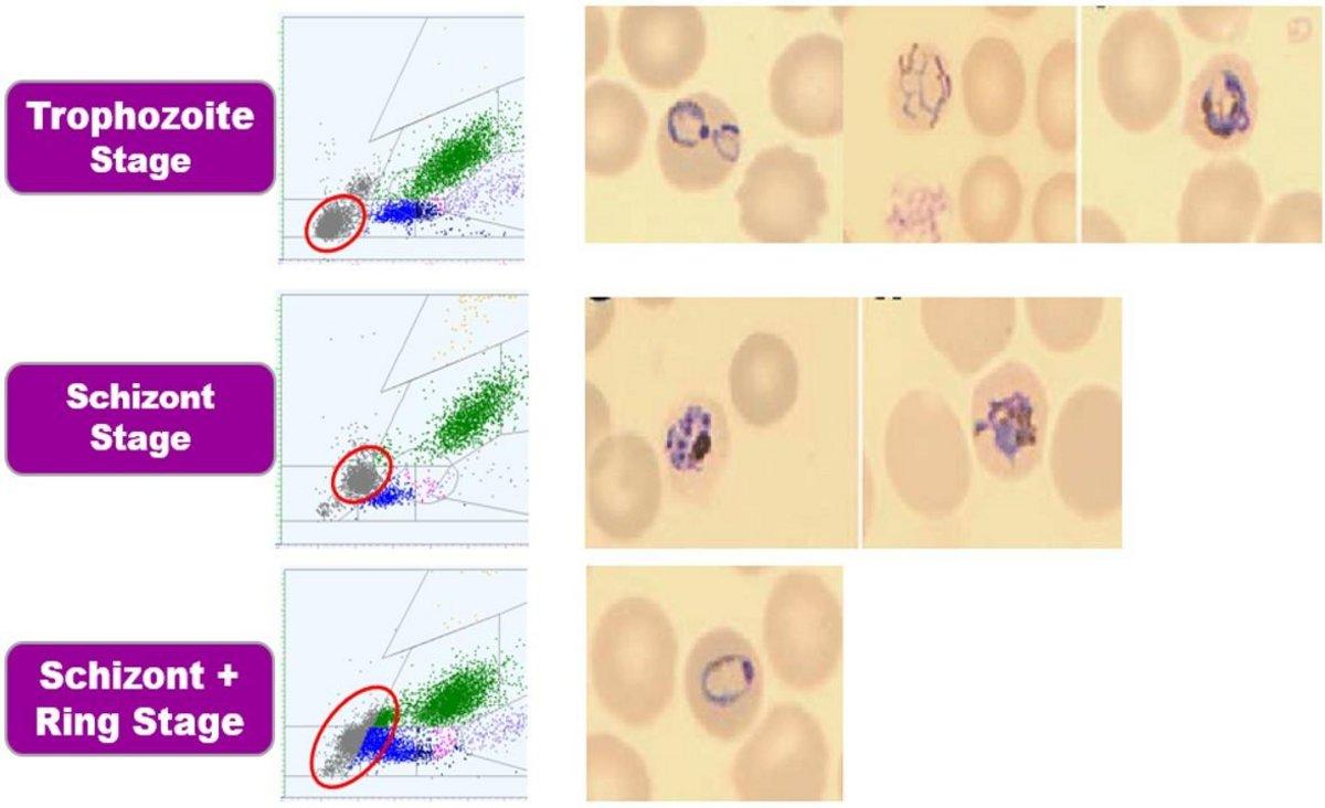 Ease of Screening Malaria & Dengue | Yumizen Hematology Analyzers