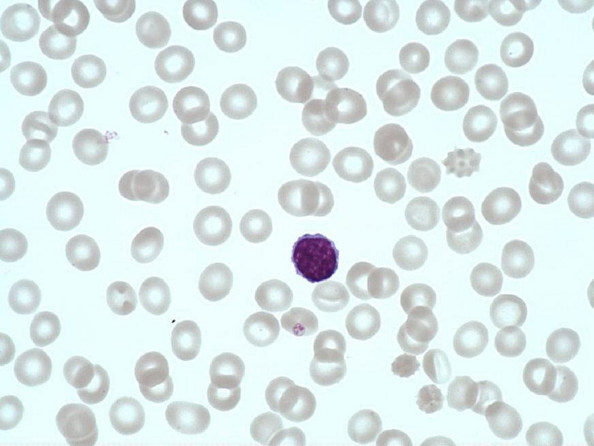 Lymphocyte - HORIBA