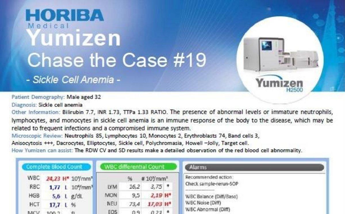 HORIBA News - HORIBA