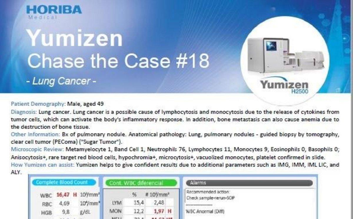 HORIBA News - HORIBA