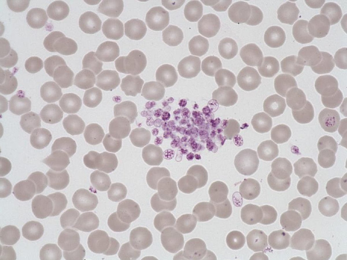 Platelet aggregate - HORIBA
