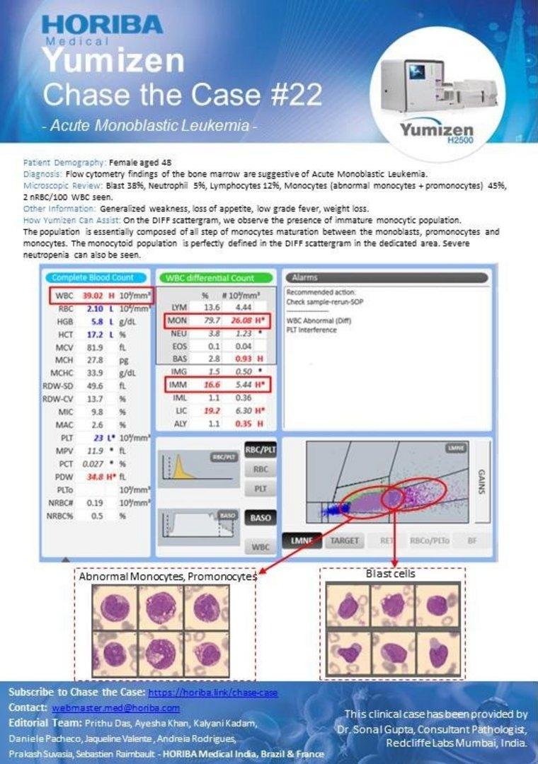 Acute Monoblastic Leukemia - Clinical Cases of Yumizen H2500 Hematology Analyzers "Chase the ...