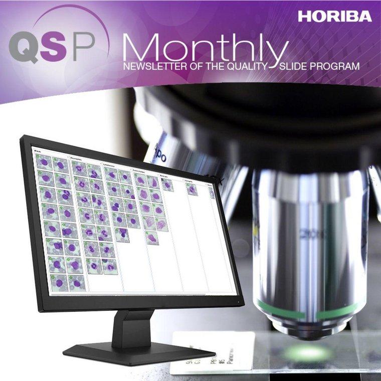 Multiple Myeloma and Microcytic Anemia - HORIBA Medical QSP Newsletter ...