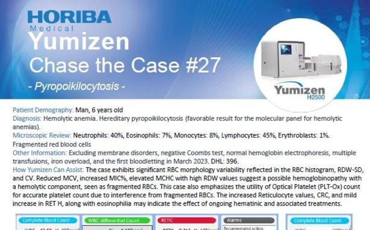 HORIBA News - HORIBA