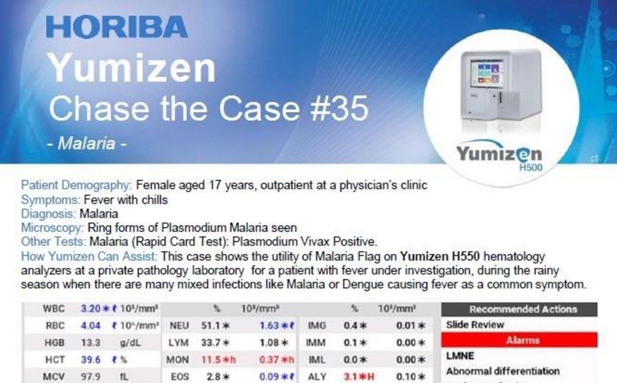 HORIBA News - HORIBA